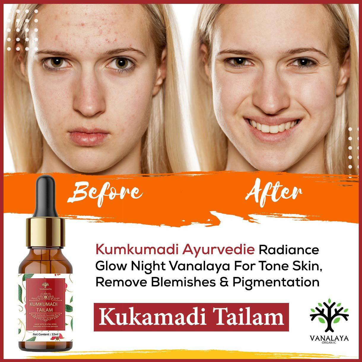 Kumkumadi Tailam Oil | Wecomart - Buy Authentic Indian Handicrafts Online